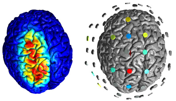 Neurophysics - Magnetic Resonance